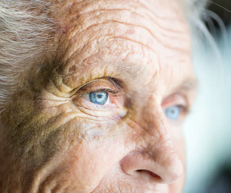 Examination and Treatment of Neglect in Stroke Patients CE Course ...